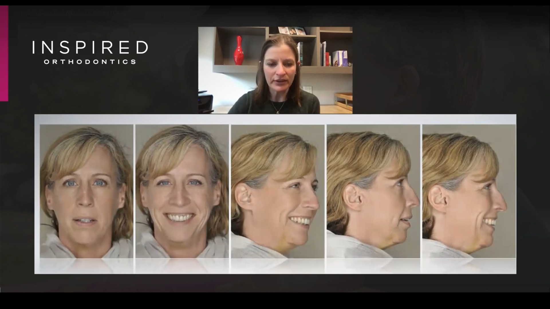 Inspired Orthodontics - Seattle Orthodontist | Bellevue WA Orthodontist ...